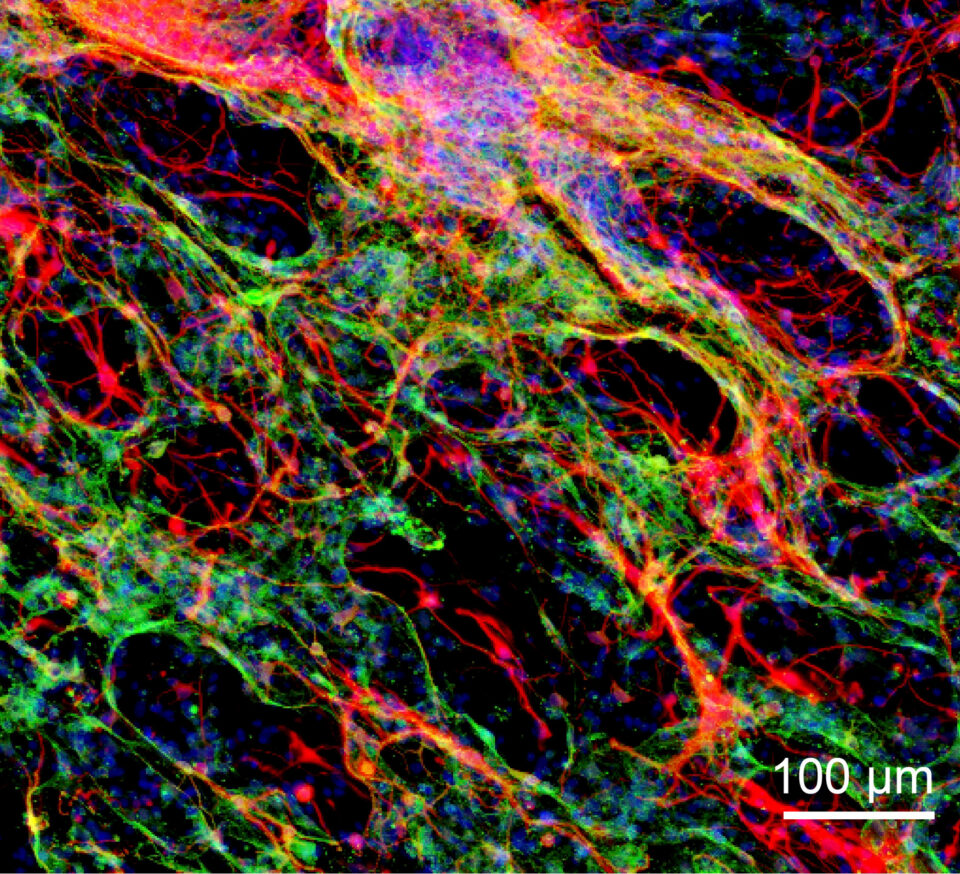 Press Release Healing the brain: hydrogels enable neuronal tissue ...